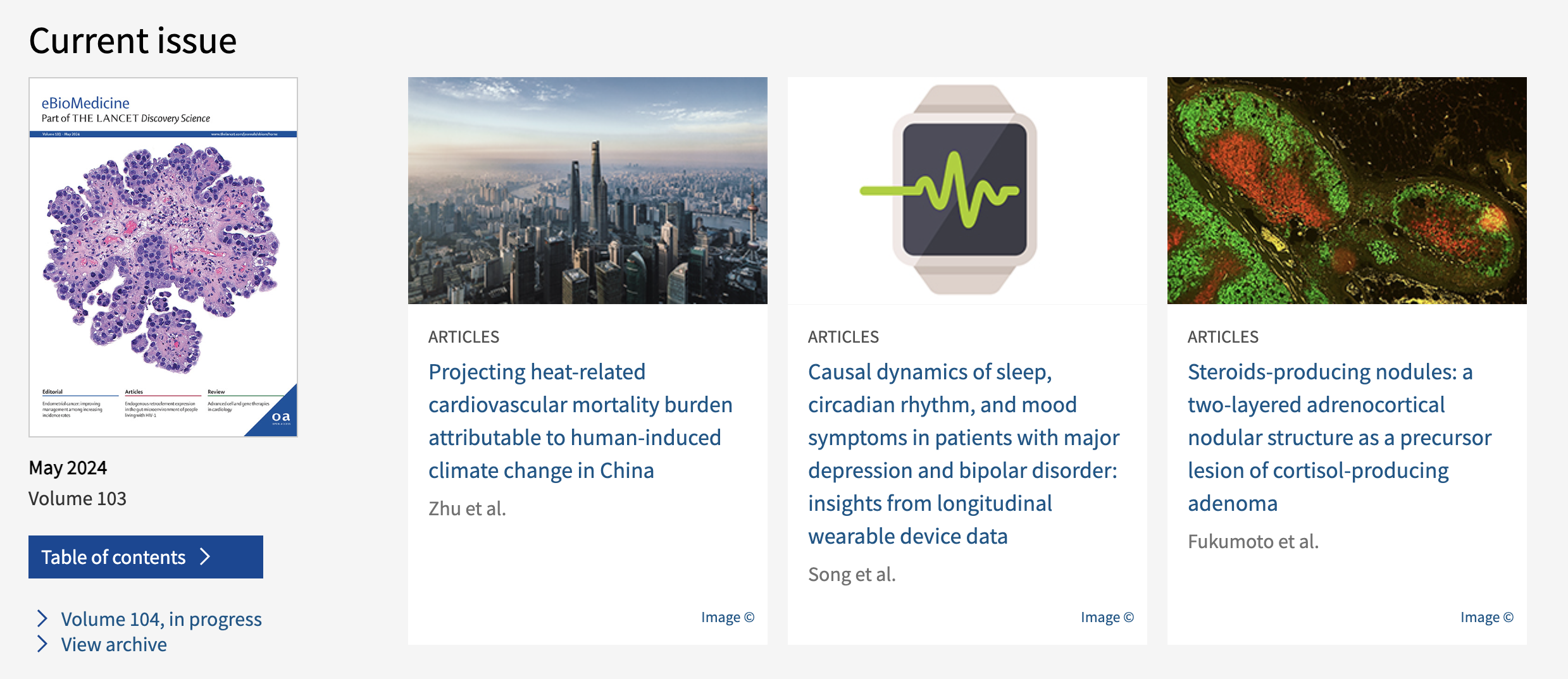Our recent paper was chosen as the May 2024 highlight in EBioMedicine. 우리 그룹의 최신 논문이 ...